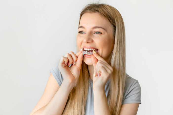 Permanent Retainer The Complete Guide to Lifelong Smile Maintenance ...